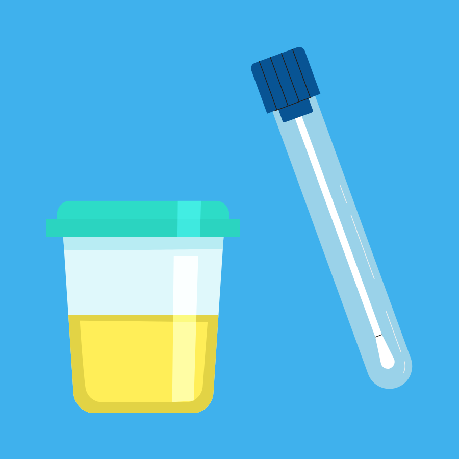 STI and BBV Testing - The YEP Project