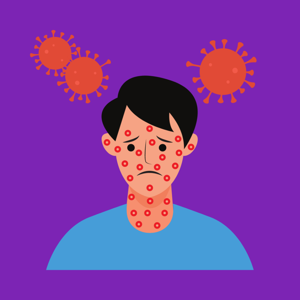 MPox (formerly Monkey Pox) - The YEP Project